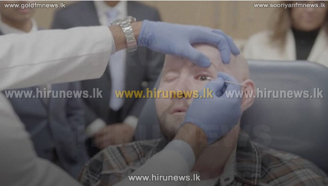 World's first complete eye transplant: breakthrough in vision ...