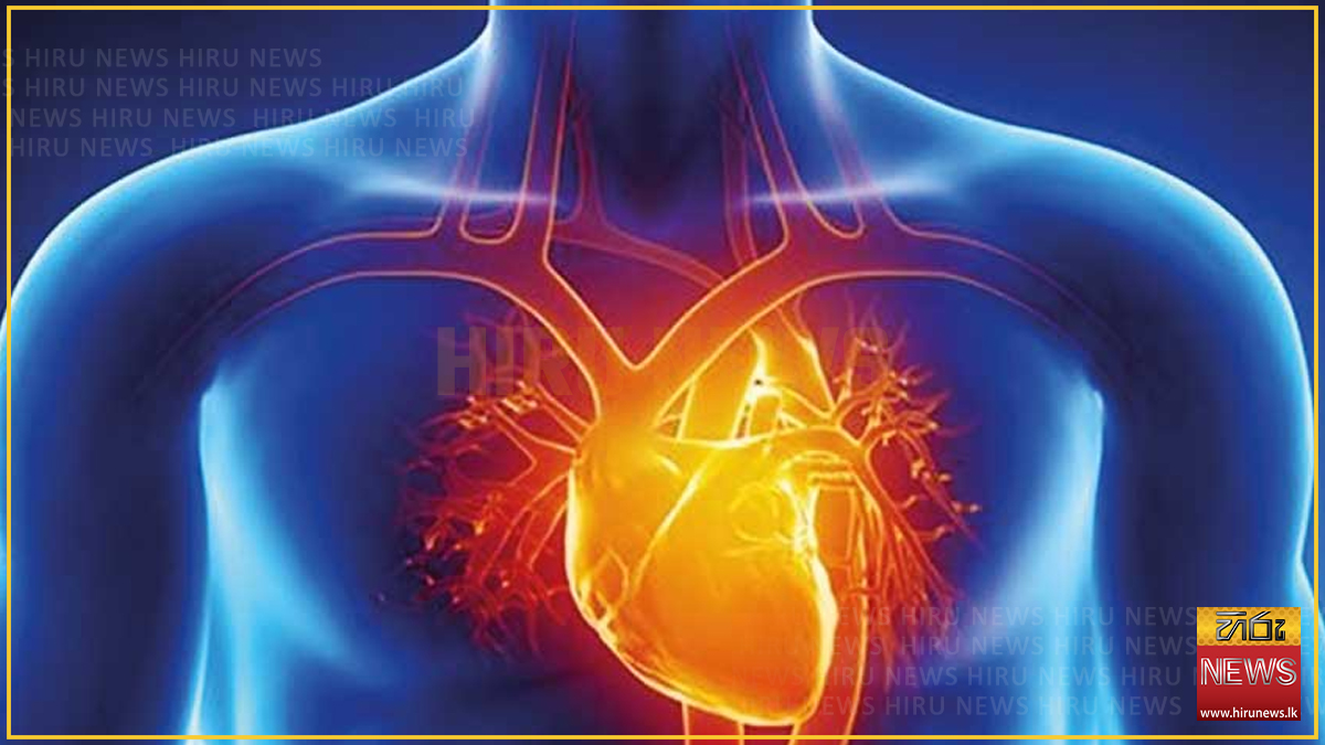Heart attack risk may rise after disaster, warns cardiologist - Hiru ...